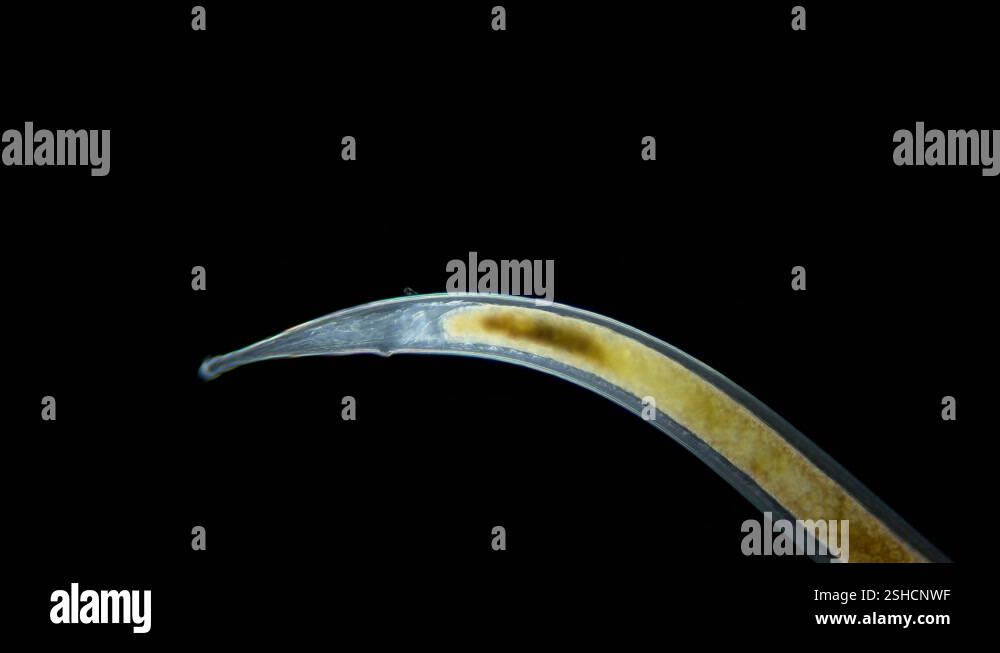 worm Nematoda under microscope, Phylum Protostomia Stock Video Footage ...