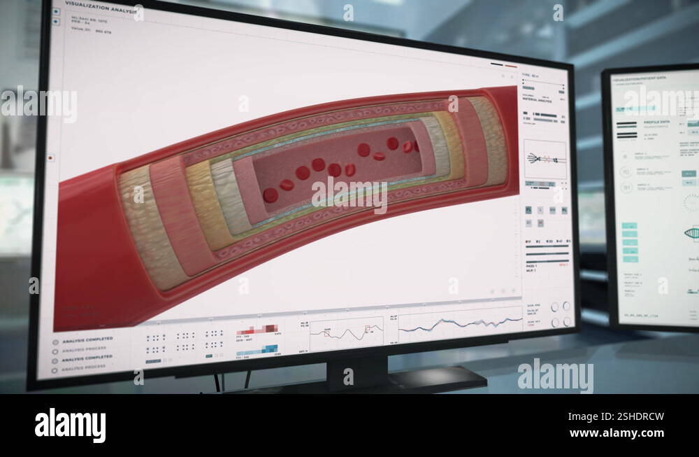 Microscopic Scanner Analyzing Blood Cells In Artery For Biology Science ...