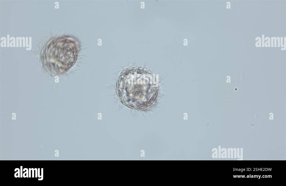 Worm larva Ophelia limacina at trochophora stage under microscope Stock ...