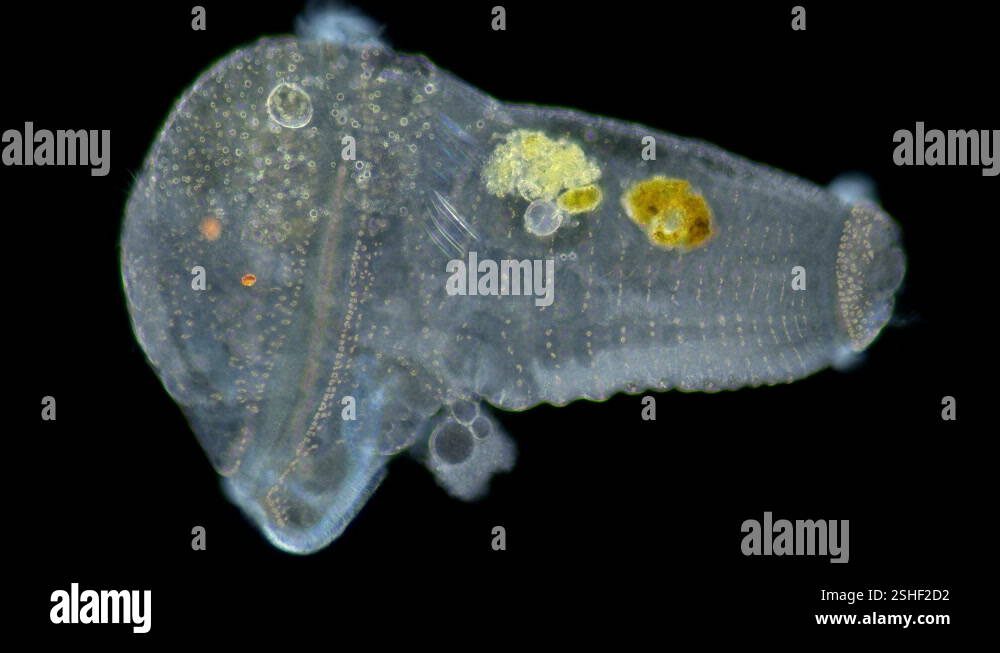 Larva of a worm at metatrochophore stage under a microscope, of family ...