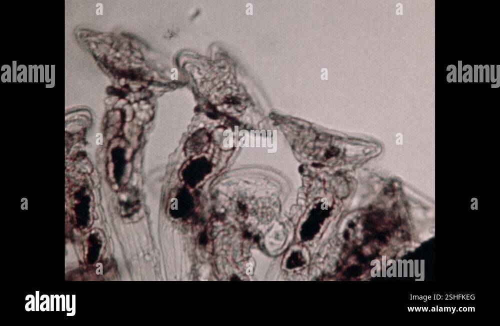 1970s: Amoebas and other aquatic organisms magnified under a ...