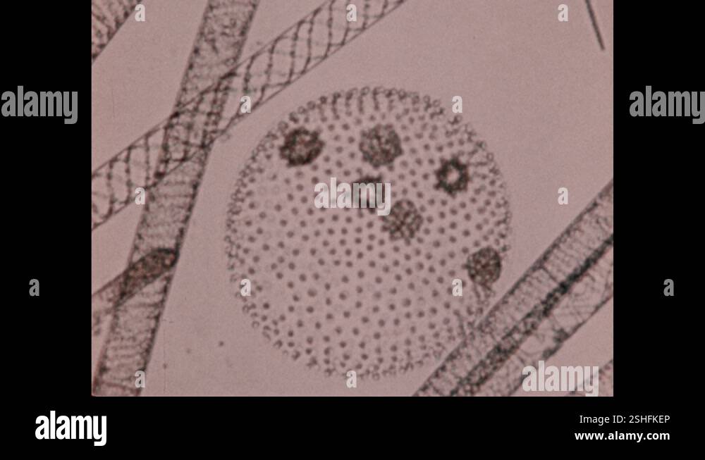 1970s: Aquatic organisms magnified under a microscopes. Amoebas from ...