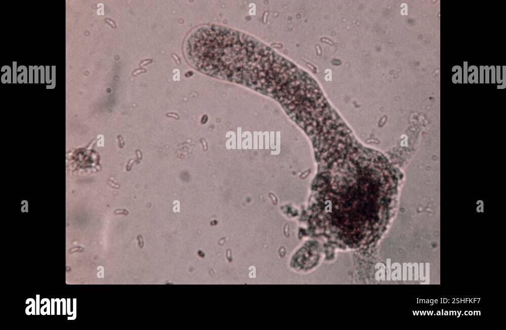 1970s: Amoebas and other small organisms magnified under a microscopes ...