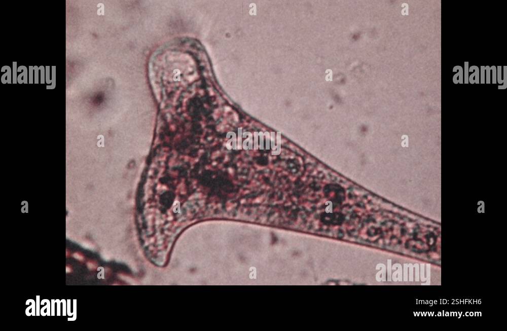 1970s: Amoebas and other aquatic organisms magnified under a ...