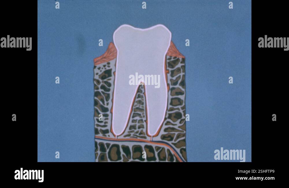 1940s: Drawing of a cross section of a tooth with various parts labeled ...