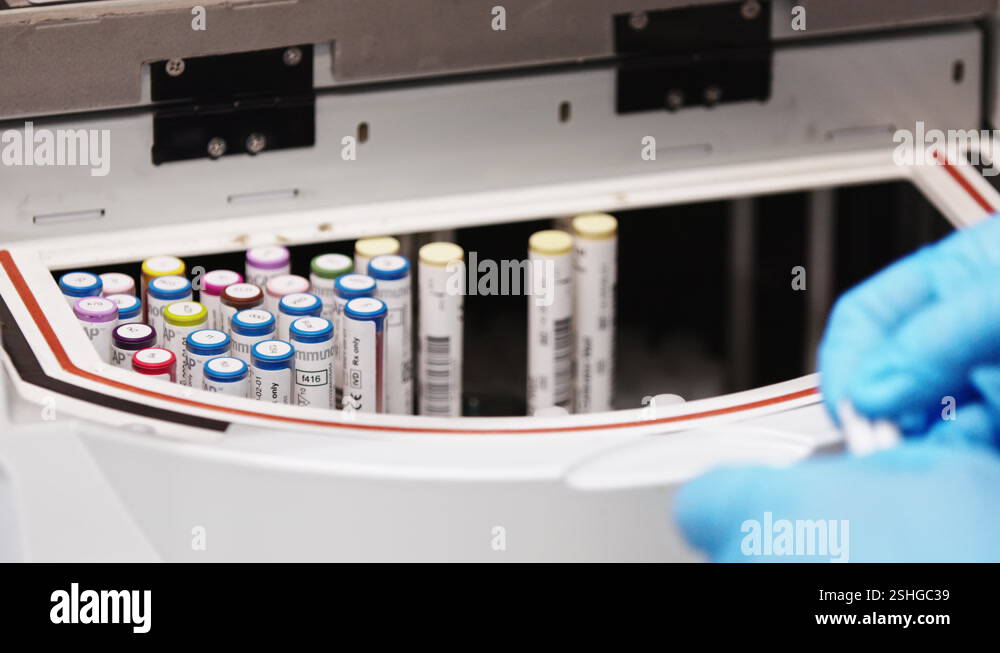 A close-up video of a hand in a blue rubber glove putting color-labeled ...