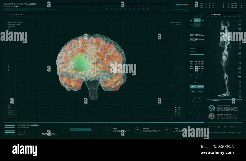 Futuristic X-ray Diagnostic Scanner Equipment Analysis Of Human Brain ...