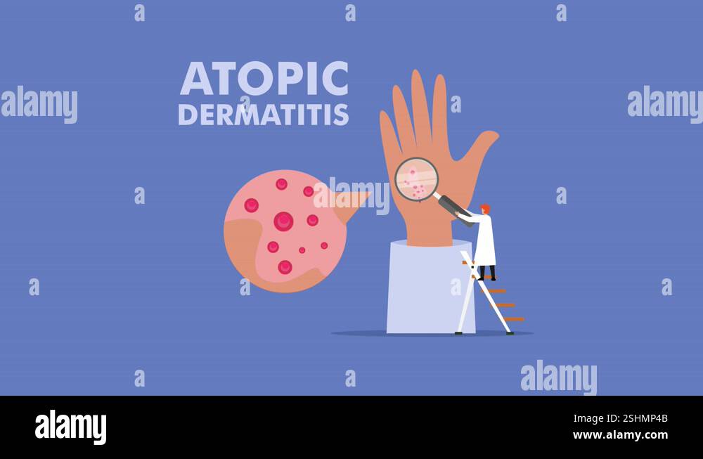 Dermatologist and Big Hand with Red Skin and Rash 2d animation in 4K ...