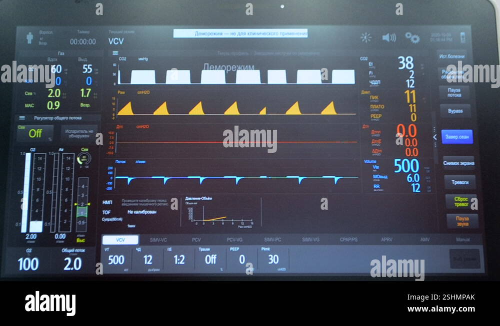 Utrasound image on monitor. Ultrasound Scan display. Screening ...