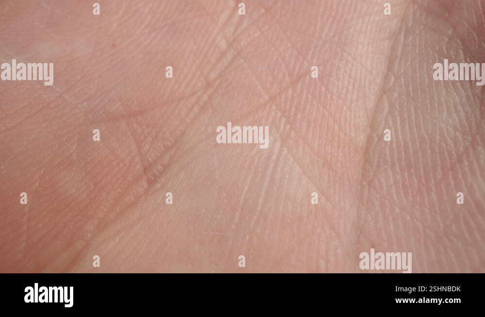 Close-up hand skin texture. Human skin, lines on hand palm macro slider ...