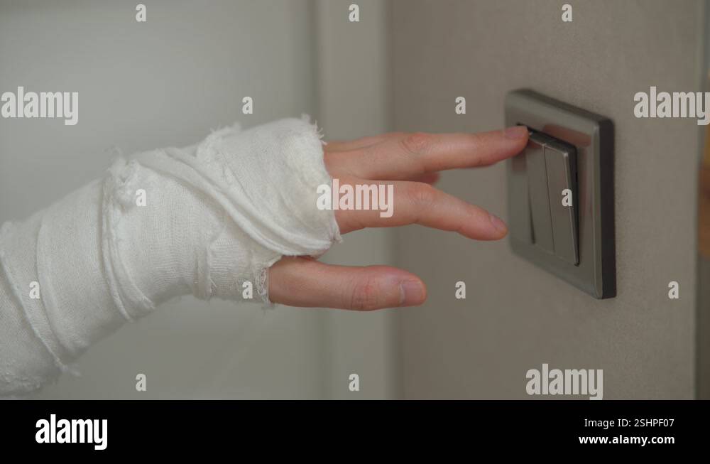 Man with plaster cast on arm presses the light on or off button Stock ...