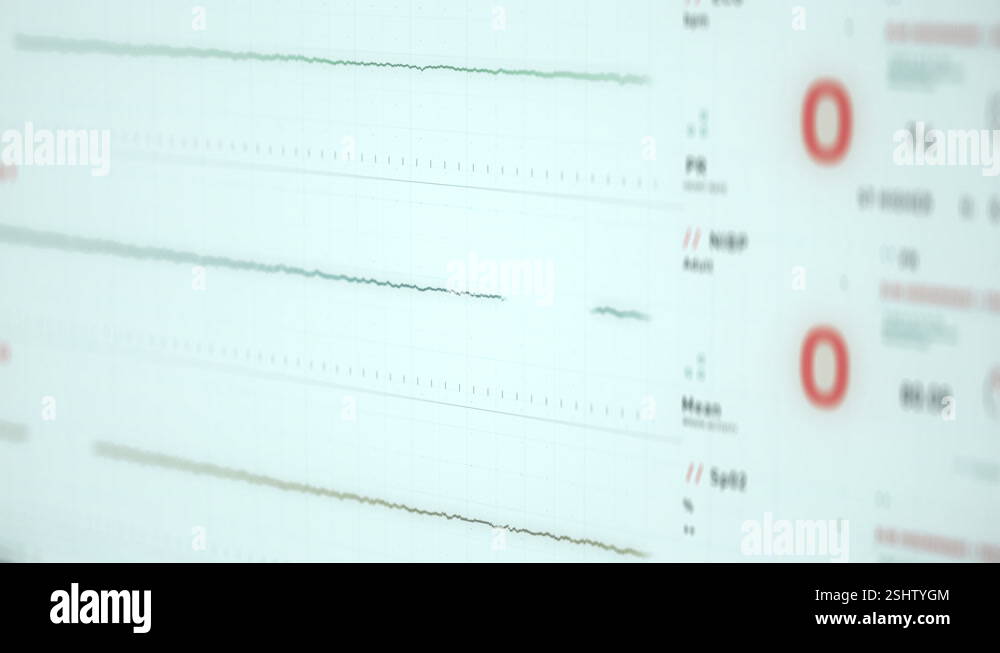Medical system alerts the doctors of the rapid decline of dying patient ...