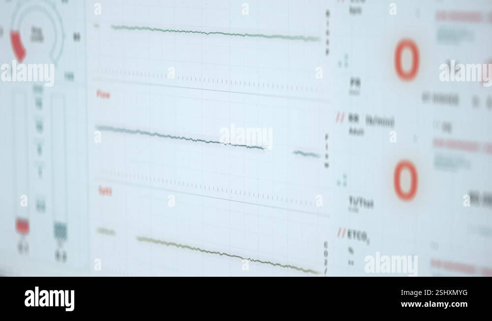 Respiratory test monitor shows the flatline of emergency patient ...