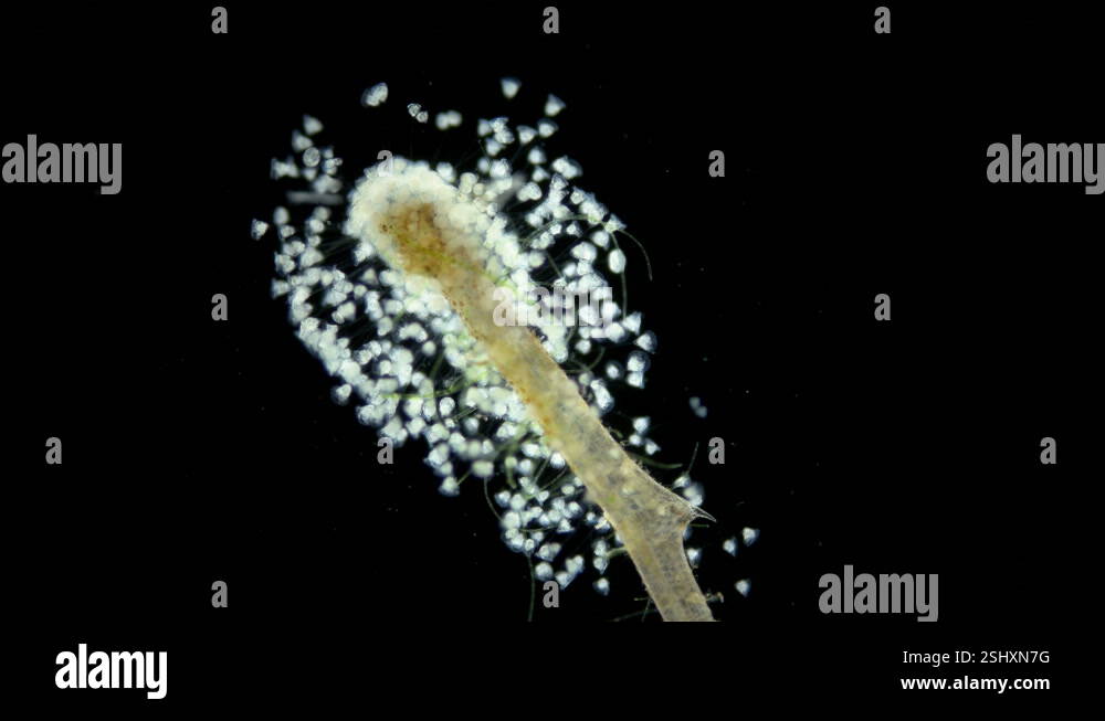 Infusoria (Ciliophora) Vorticella under microscope, class ...