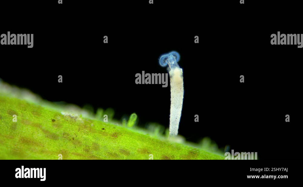 Rotifera family Flosculariidae under a microscope, possibly Limnias sp ...