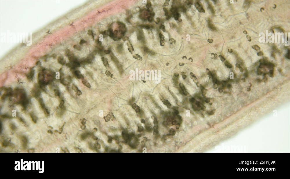 Leech family Erpobdellidae under a microscope, Arhynchobdellida ...