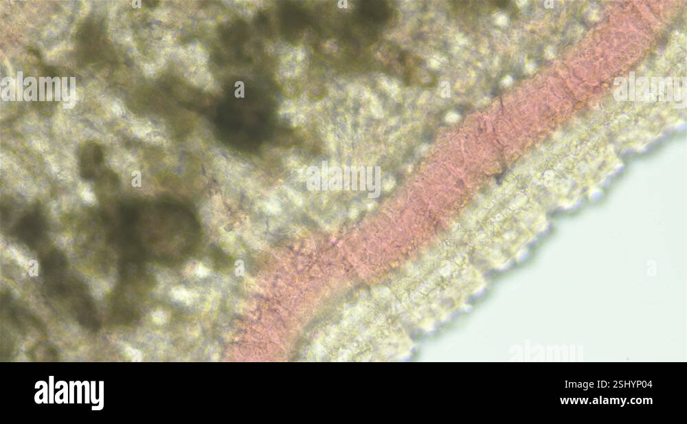 Leech family Erpobdellidae under a microscope, Arhynchobdellida ...