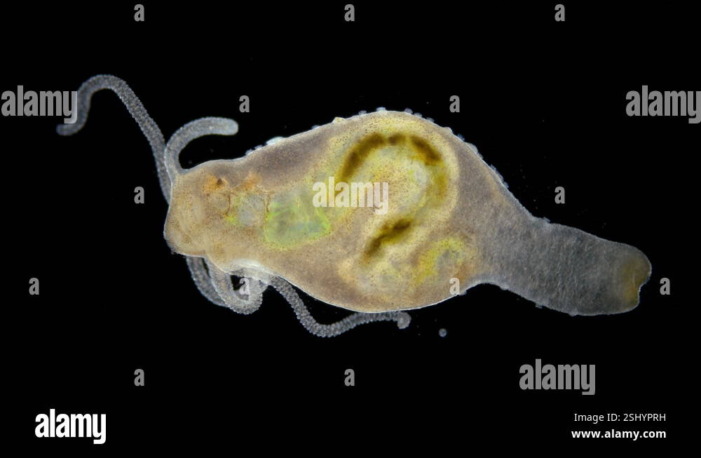Hydra, Hydrozoa and Infusoria Kerona polyporum, Trichodina under ...