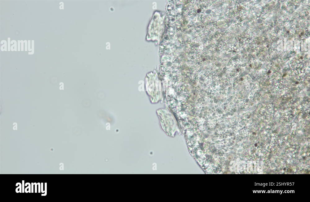 Infusoria Ciliophora Kerona polyporum and Trichodina under microscope ...
