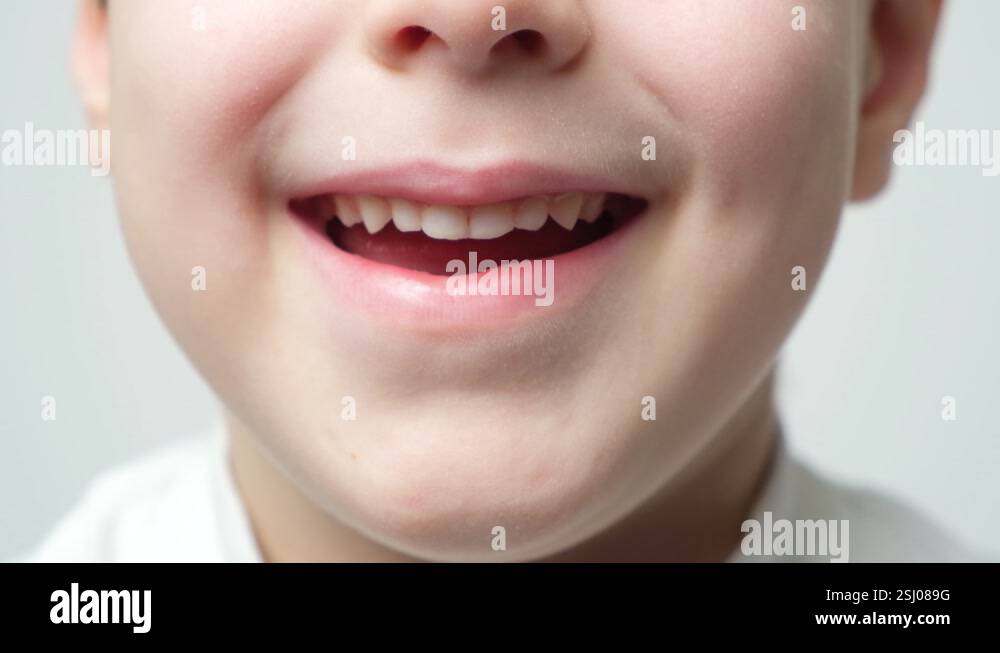 A preschooler's smile, close-up lips. Baby teeth. The child stretches ...