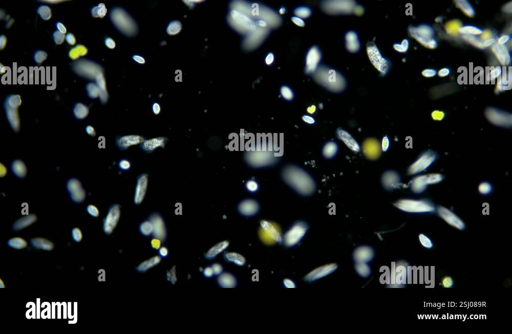 colony Ciliophora Hypotrichia and Coleps under microscope, Planktonic ...