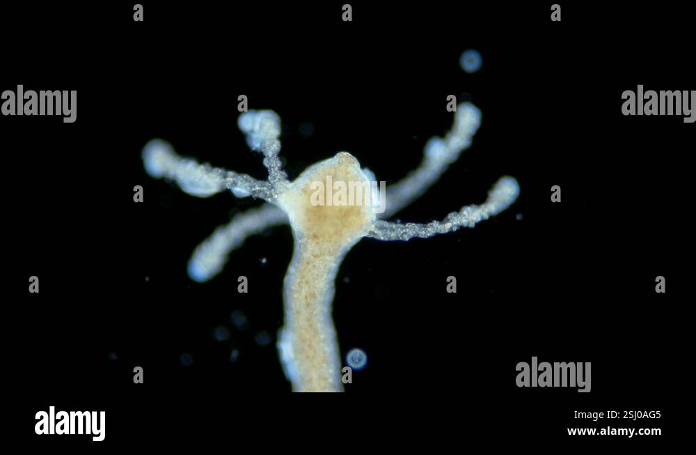 Hydra, Hydrozoa and Infusoria Kerona polyporum, Trichodina under ...