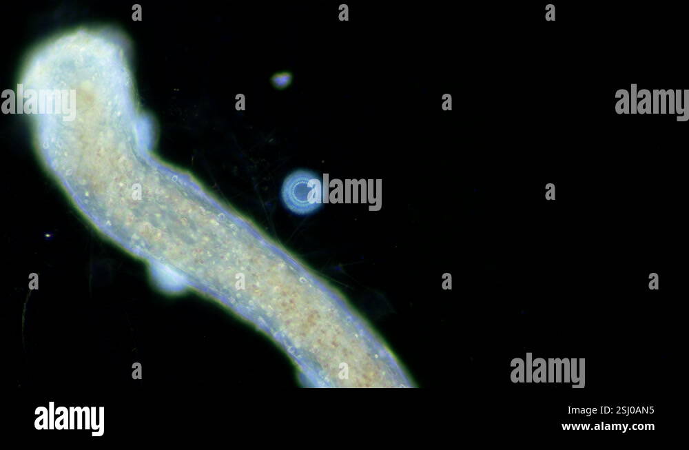 Parasitic Ciliophora Trichodinidae under microscope, Mobilida ...