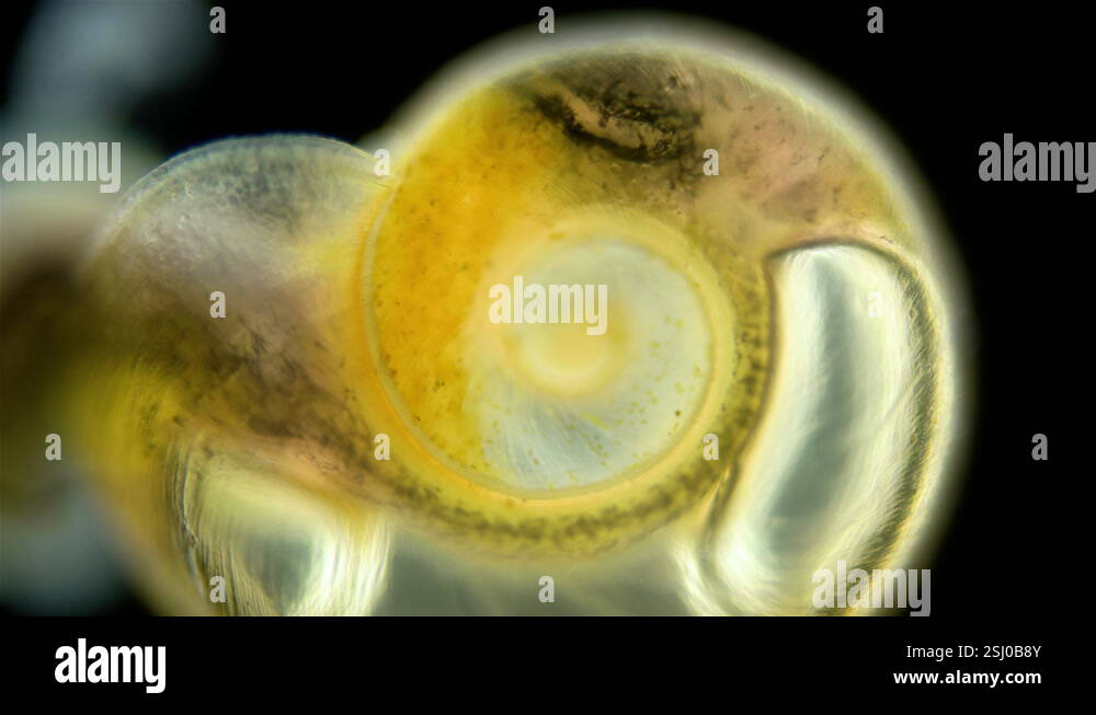 Snail Family Planorbidae under microscope, order Pulmonata. Anisus sp ...