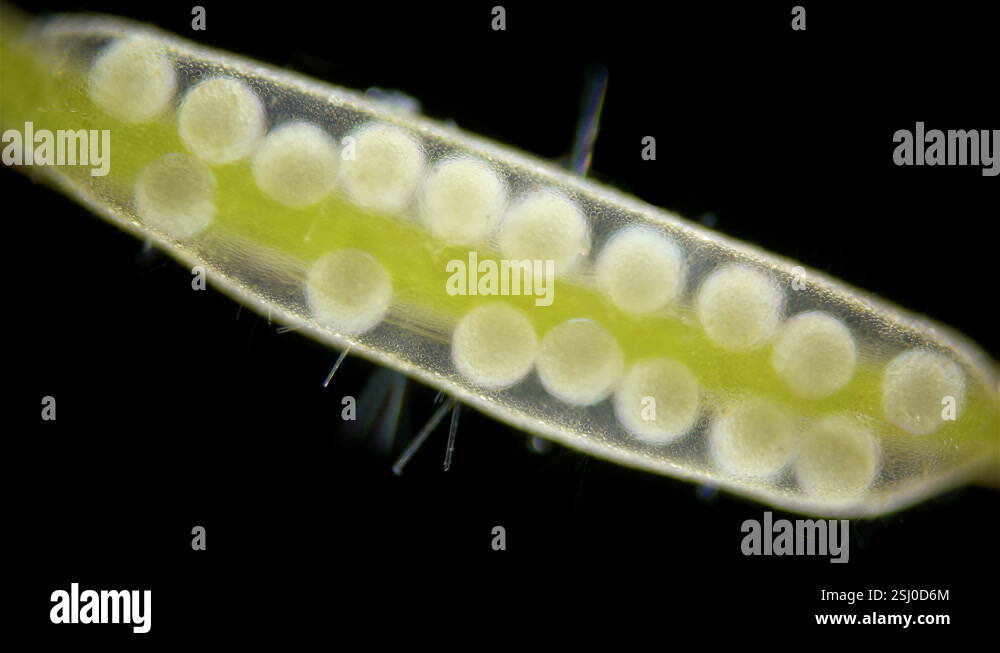 Cocoon with Eggs and Larvae water mites Hydrachnidia under a microscope ...
