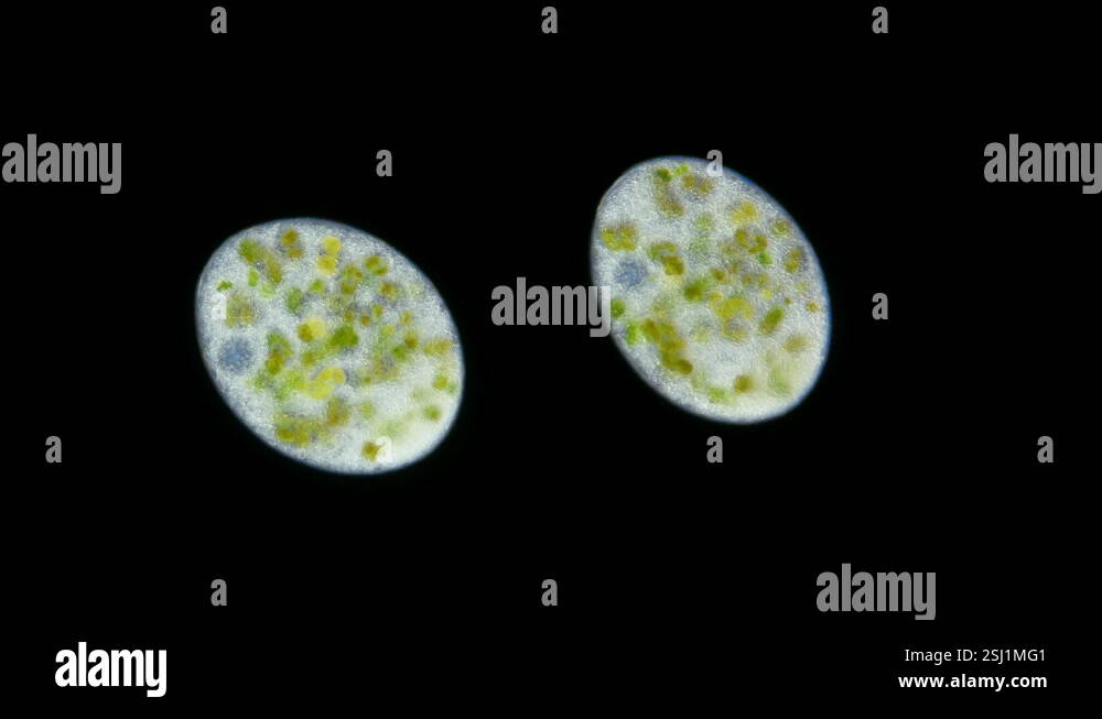 Ciliophora under a microscope, class Ciliata, possibly order ...