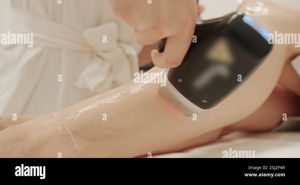 Hardware removal of hair on the legs in a beauty salon. Laser epilation ...