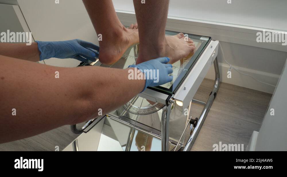 A person stands on a pressure platform in the podologist Stock Video ...