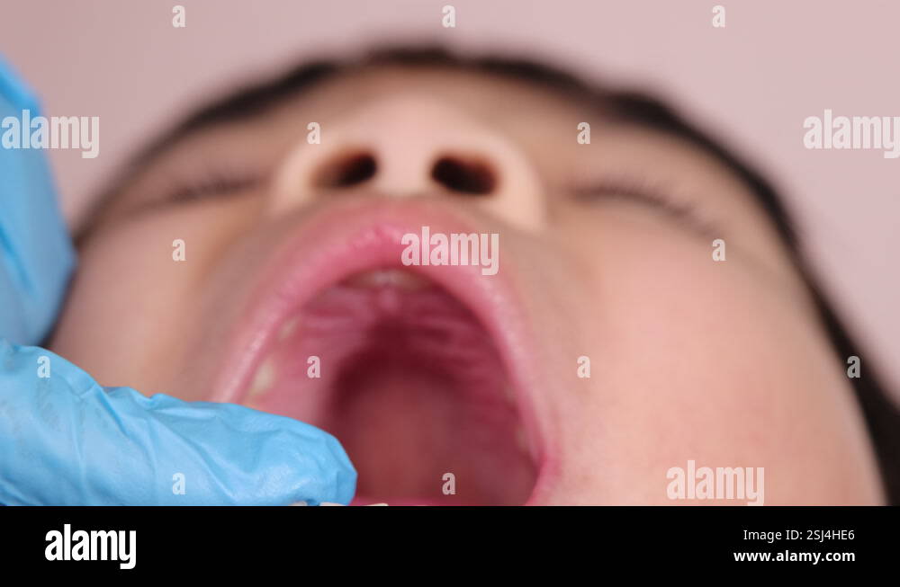 Close-up of the hard and soft palate in the mouth of healthy child ...