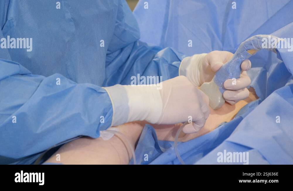 Surgical operation on leg veins, endovenous ablation, sclerotherapy and vein Stock Video Footage ...