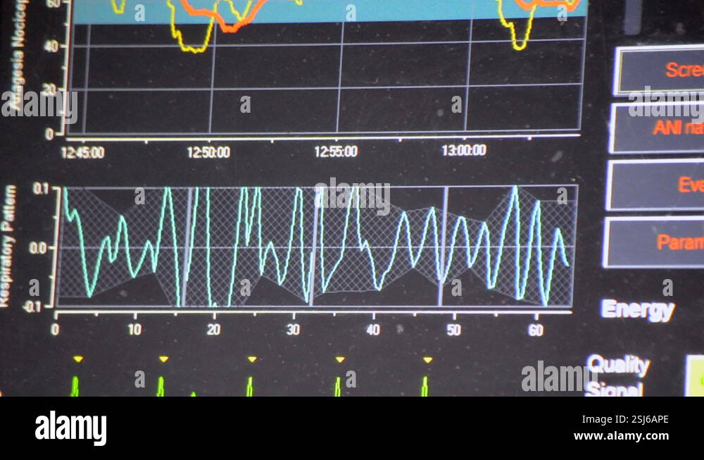 Modern patient monitor. Electronic Health Monitor displaying medical ...