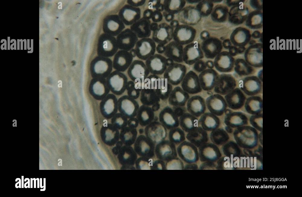 1950s: Cell is enlarged under microscope. Surgeon performs brain ...
