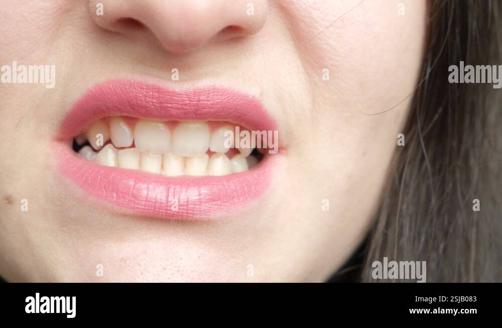 The woman grits her teeth. Improper abrasion of teeth, grinding of ...