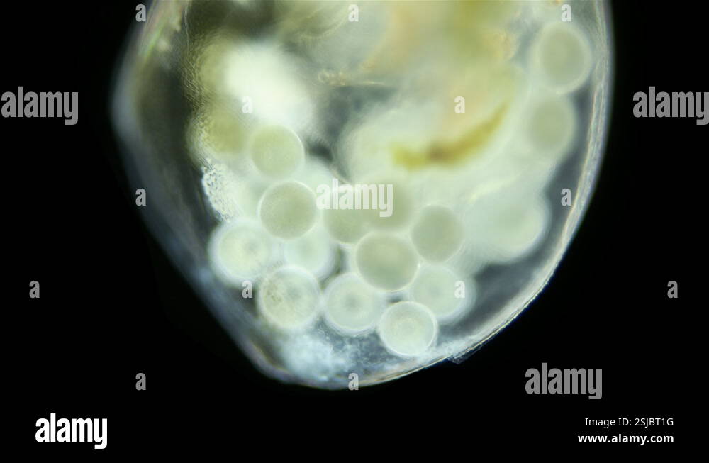 Water flea Daphnia Simocephalus vetulus under a microscope, Daphniidae ...