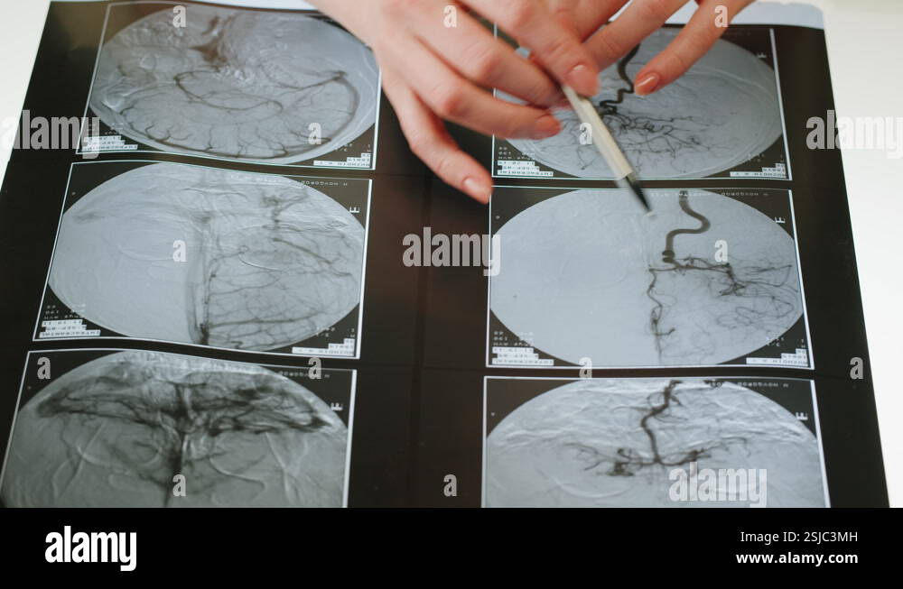 Magnetic resonance image of head, X-ray. Doctor examining blood vessels ...