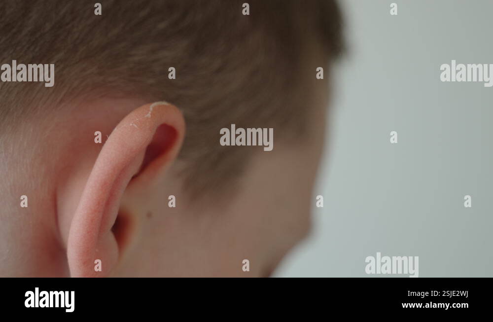 Ear skin Stock Videos & Footage - HD and 4K Video Clips - Alamy
