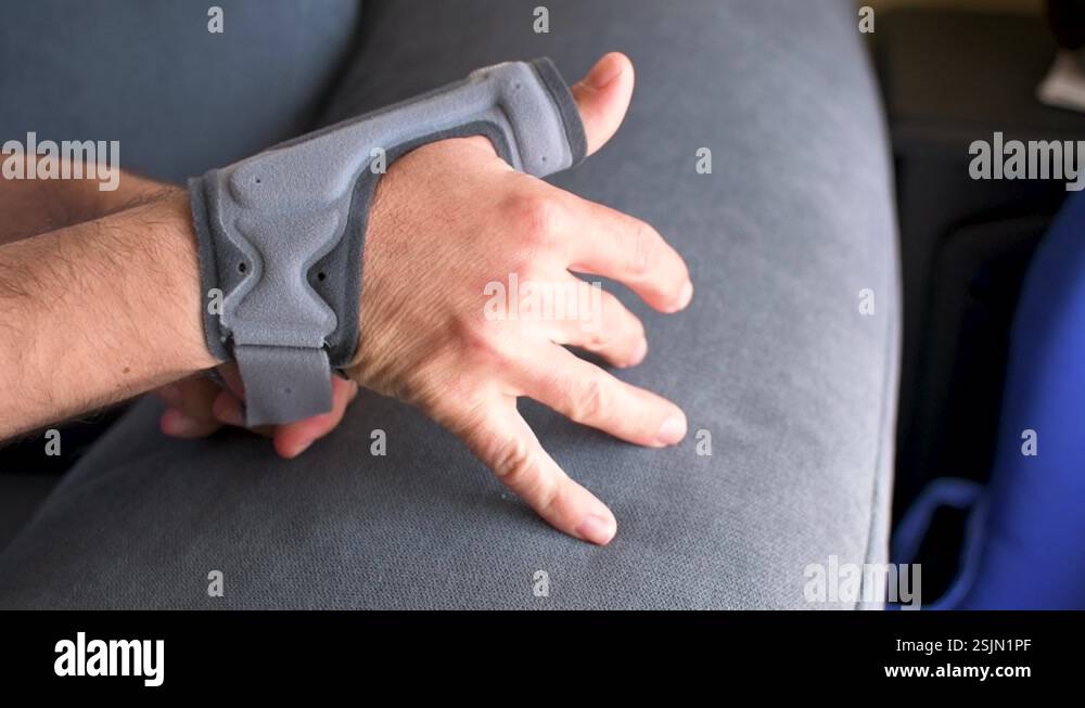 De quervains tenosynovitis Stock Videos & Footage - HD and 4K Video ...