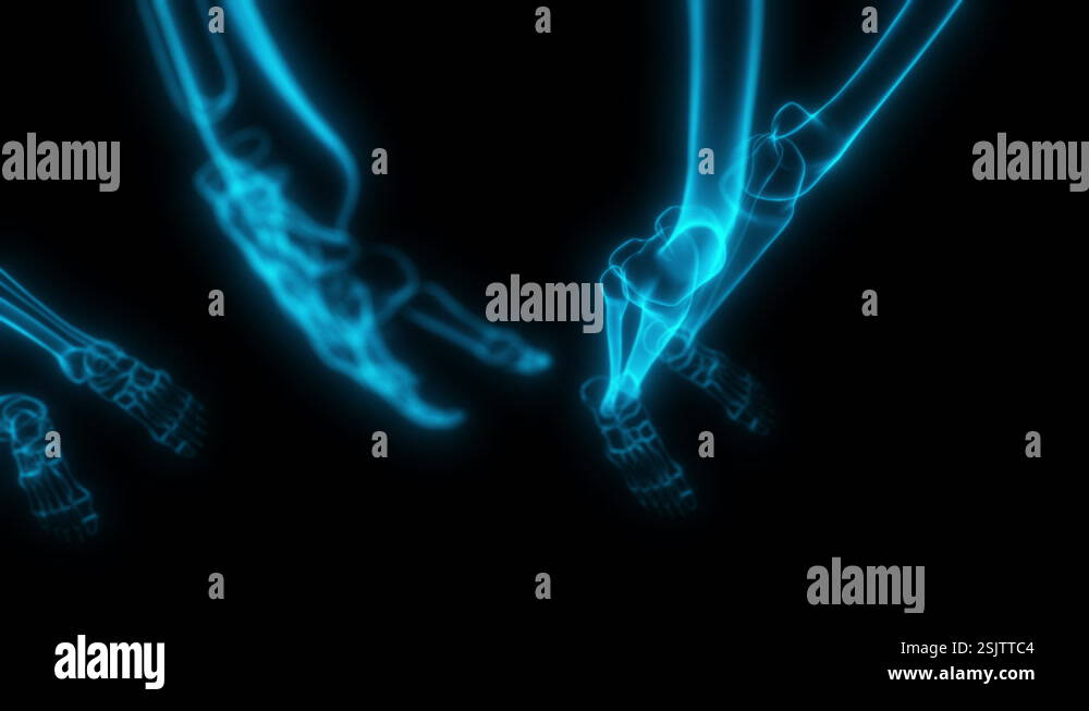 3D Holographic X-Ray Rotating View of Multiple Human Body Skeletons ...