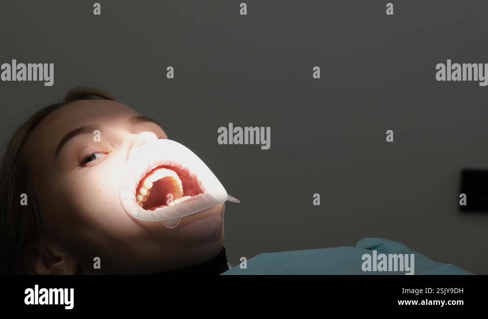 Female patient with open mouth during dental treatment. Capa during ...
