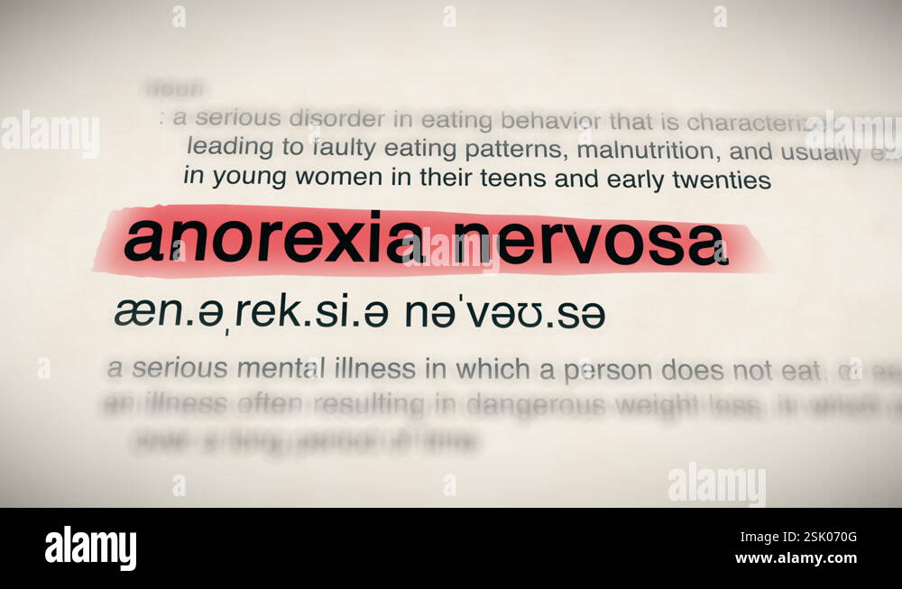 Anorexia nervosa illustration Stock Videos & Footage - HD and 4K Video ...