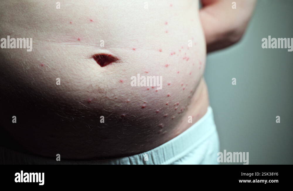 Stomach belly button Stock Videos & Footage - HD and 4K Video Clips - Alamy