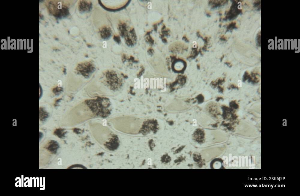 1960s: Organisms move through fluid on microscope slide Stock Video ...