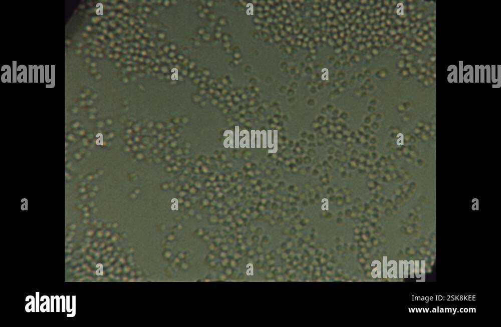1960s: Clusters of cells cling together under magnification Stock Video ...