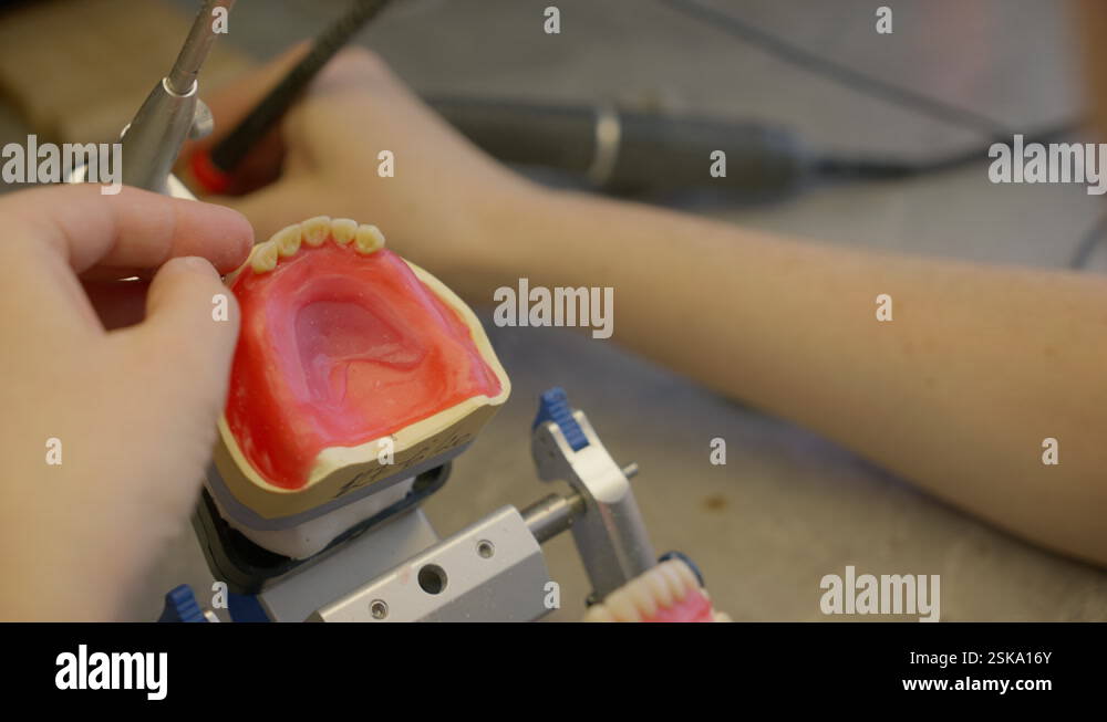 Applying the hot dental glue on the base to insert fake replacement ...