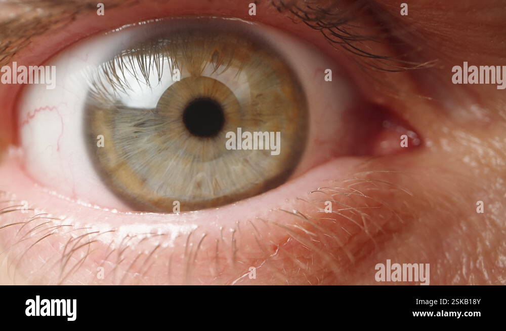 A wide-open male eye is looking straight ahead, with a green iris ...