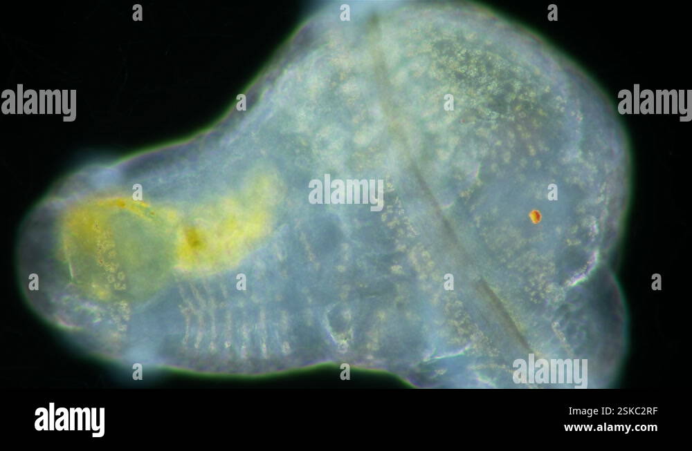 Larva of a worm at metatrochophore stage under a microscope, of family ...
